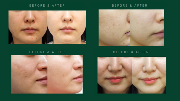 LEMON BOTTLE SKIN BOOSTER - FAROHA