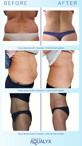 AQUALYX FAT DISSOLVER - FAROHA