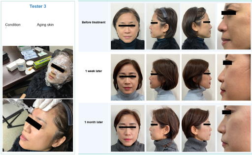 KIARA REJU SKIN BOOSTER - FAROHA