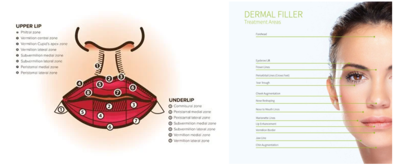 A Complete Guide On How To Use Your Hyaluron Pen with Lipo Lab+ - FAROHA