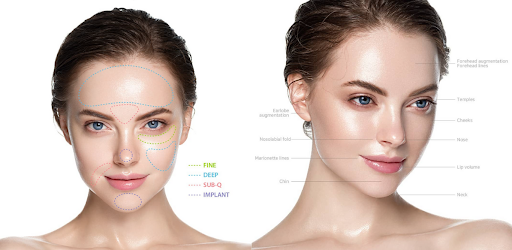 EXQUILLER DERMAL FILLERS - FAROHA