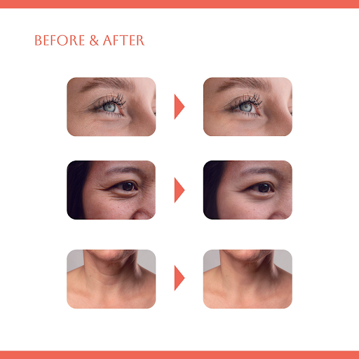 EYEBELLA SKIN BOOSTER - FAROHA