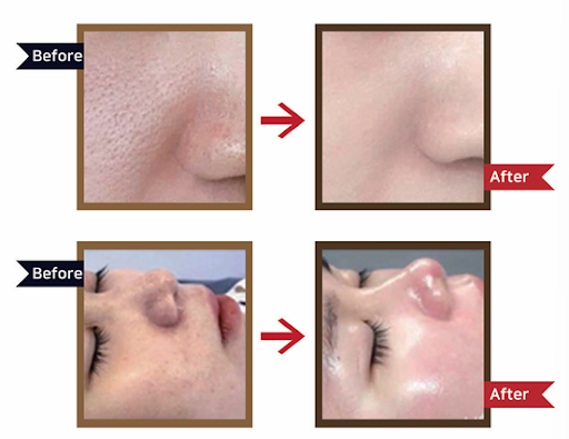 GOLD CELL SKIN BOOSTER - FAROHA