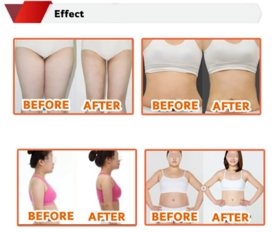 V-LINE A SOLUTION FAT DISSOLVER ESSENCE - FAROHA