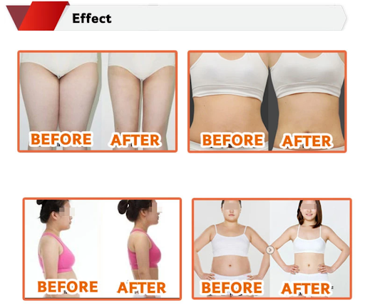 V-LINE A SOLUTION FAT DISSOLVER ESSENCE - FAROHA